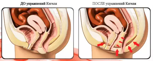 Kegel әйелдер жаттығуы үшін